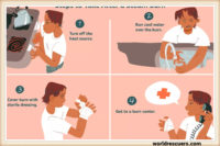 Burned with Steam: Causes, Treatment, and Prevention