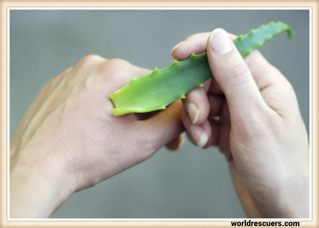 Burned with Steam: Causes, Treatment, and Prevention